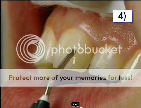 BEAUTIFUL TOOTH JEWELS CRYSTAL TEETH STONES 10 GEMS KIT